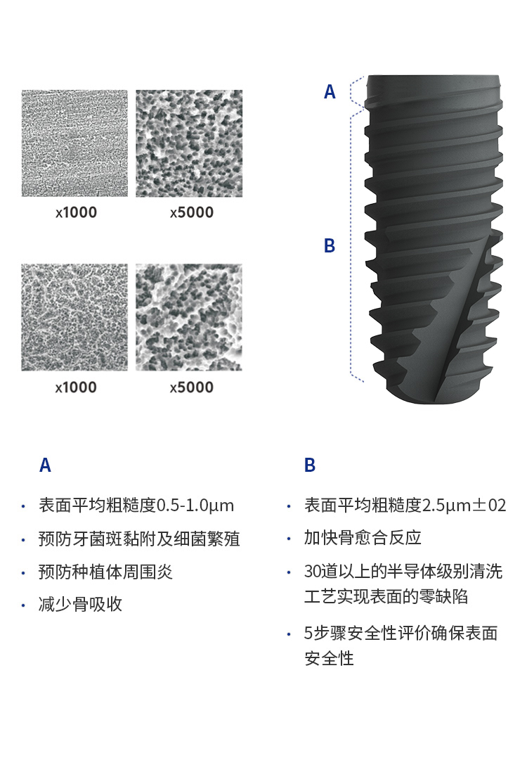 SLA Surface Treatment